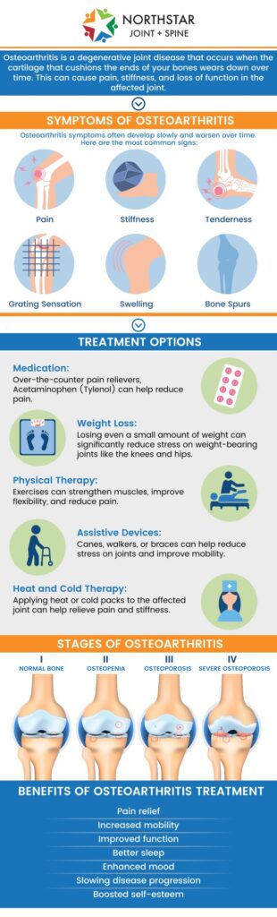 Management & Treatment of Knee Osteoarthritis in Plano TX