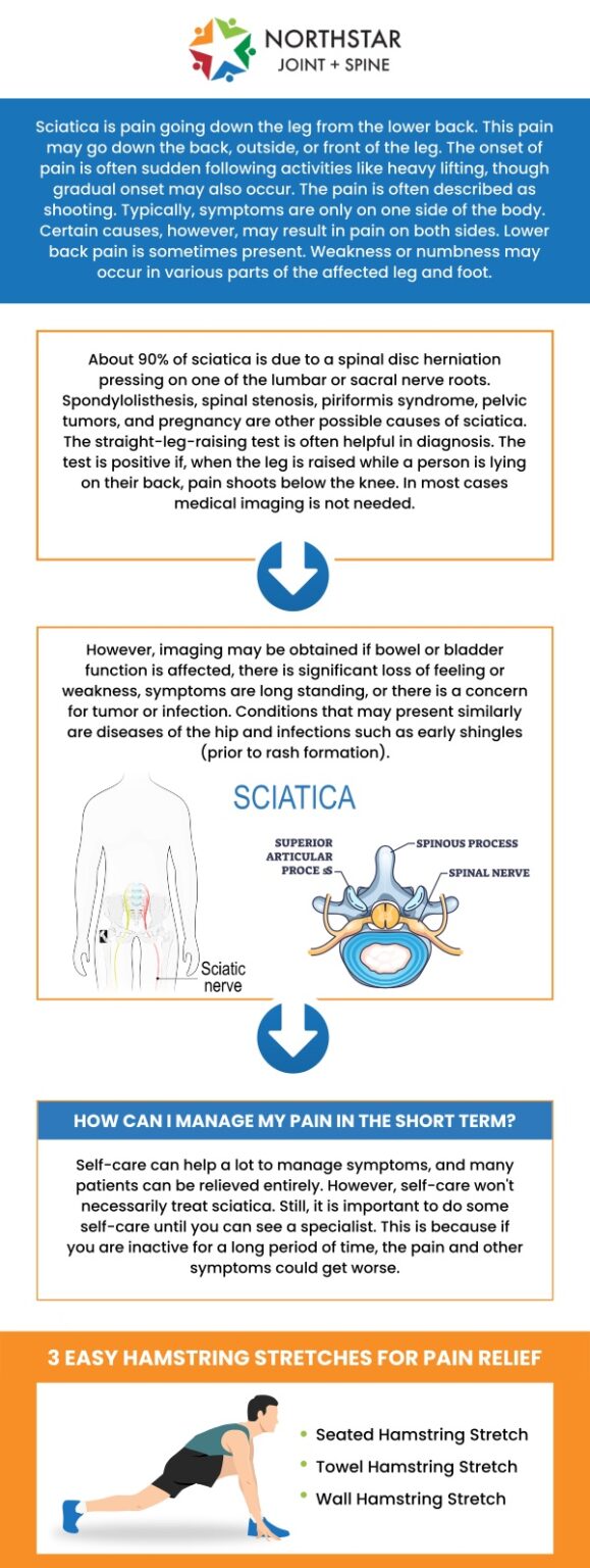 How Does Sciatica Pain Feel? | Dr. Robert J. Nocerini